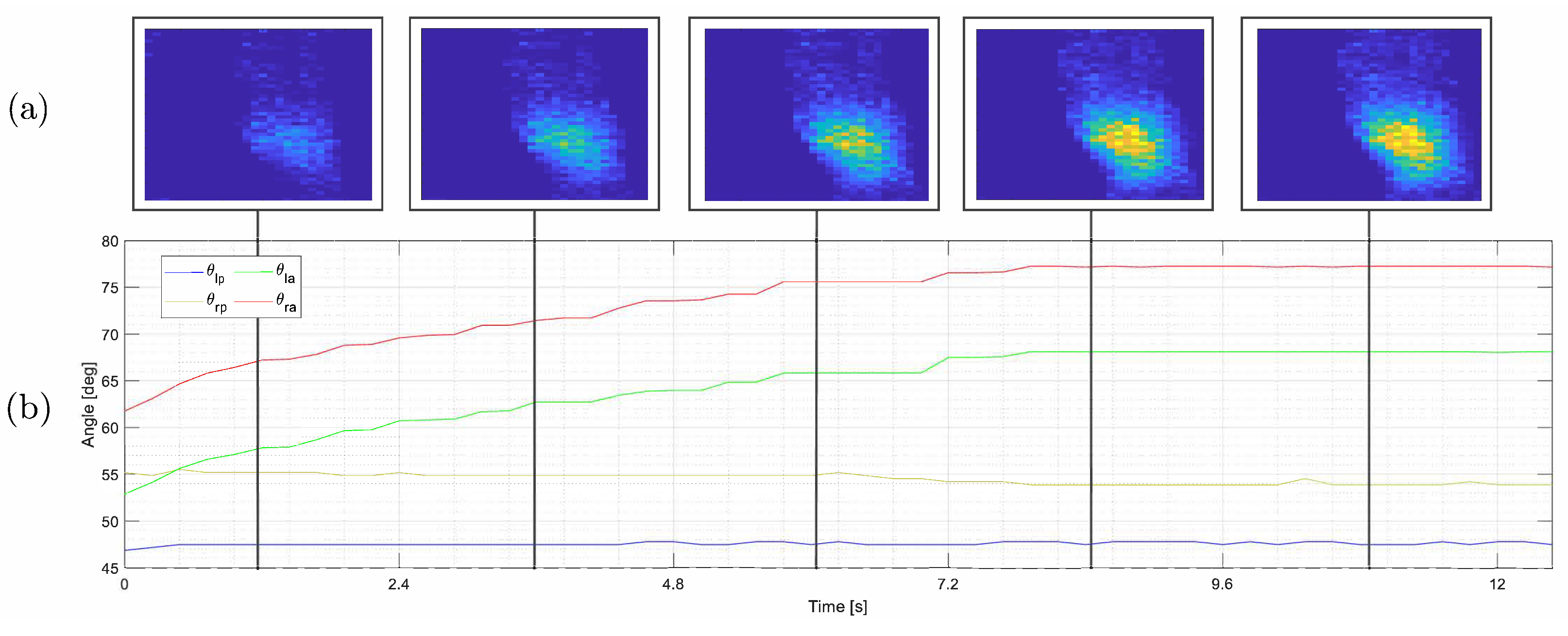 Sensors | Free Full-Text | Dataset with Tactile and Kinesthetic Information from a Human Forearm ...