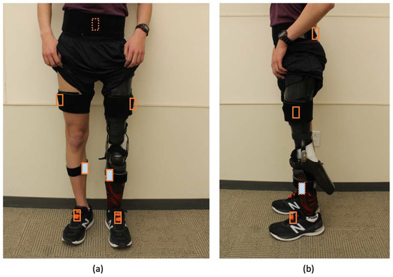 Rules-Based Real-Time Gait Event Detection Algorithm for Lower-Limb Prosthesis Users during ...