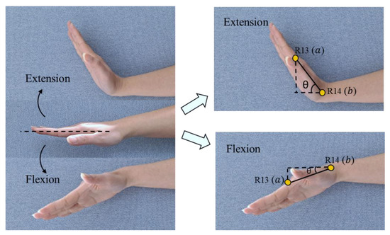 Sensor-Based Motion Tracking System Evaluation for RULA in Assembly Task
