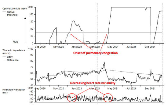 Wearable Devices for Remote Monitoring of Heart Rate and Heart Rate ...