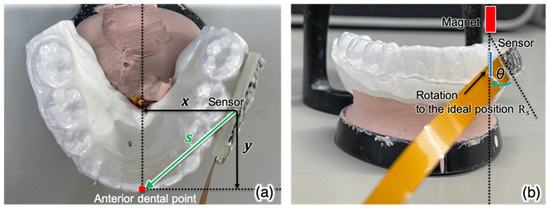 A New Intraoral Six-Degrees-of-Freedom Jaw Movement Tracking Method ...
