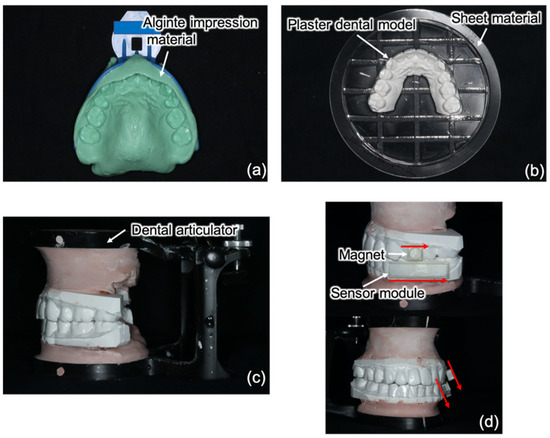 A New Intraoral Six-Degrees-of-Freedom Jaw Movement Tracking Method ...