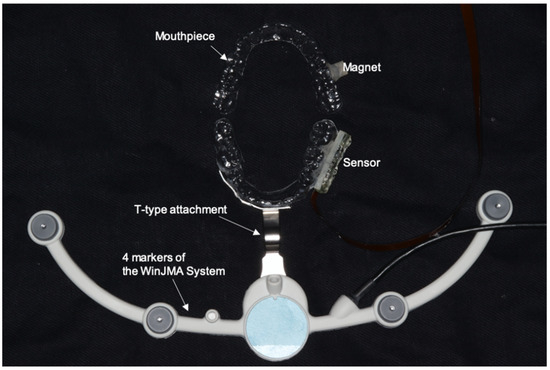 A New Intraoral Six-Degrees-of-Freedom Jaw Movement Tracking Method ...
