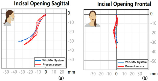 A New Intraoral Six-Degrees-of-Freedom Jaw Movement Tracking Method ...
