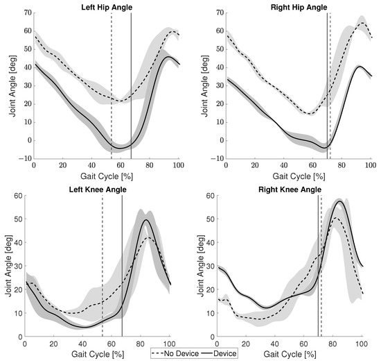 Passive Exoskeleton with Gait-Based Knee Joint Support for Individuals ...