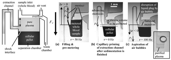 Microvalves for Applications in Centrifugal Microfluidics