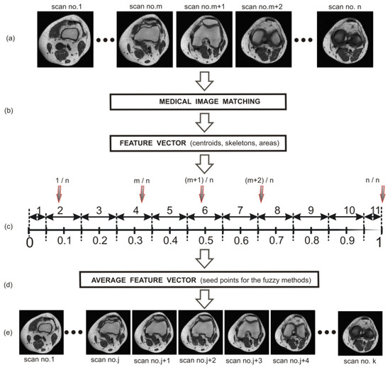 Atlas-Based Segmentation in Extraction of Knee Joint Bone Structures ...