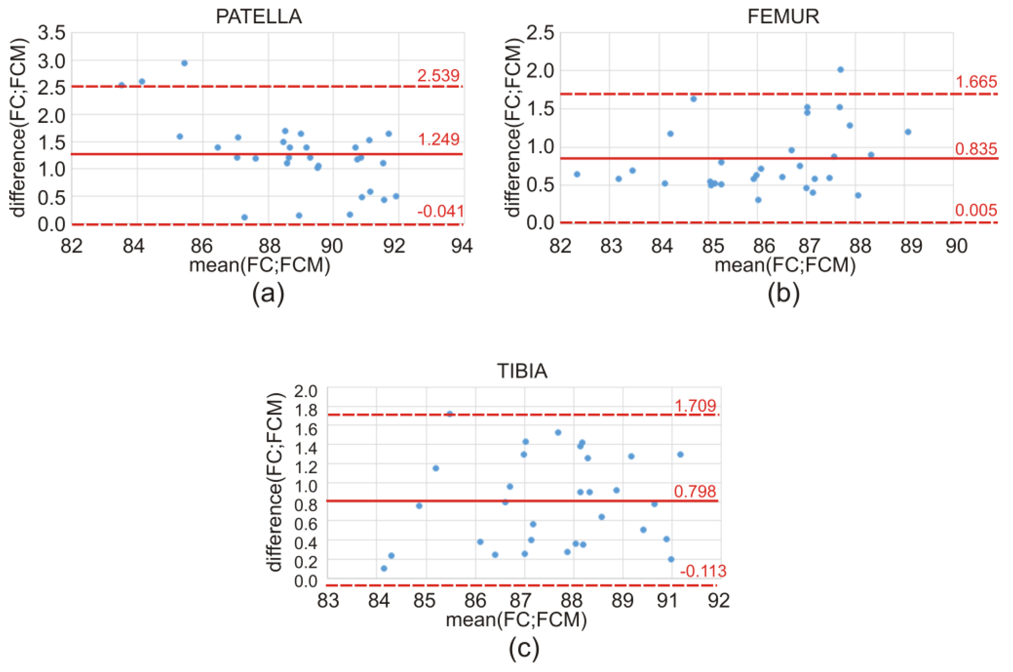 Atlas-Based Segmentation in Extraction of Knee Joint Bone Structures ...