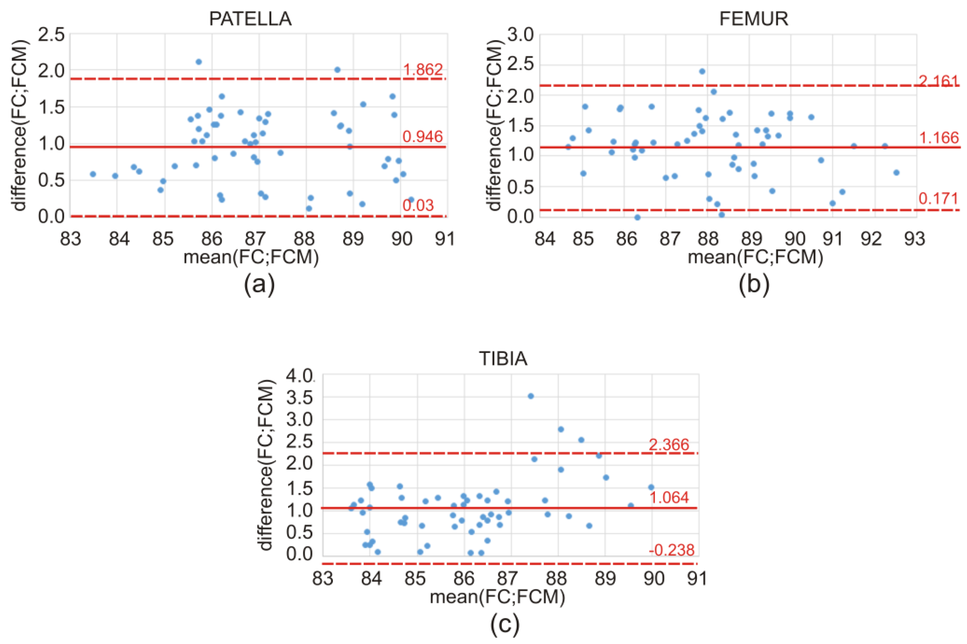 Atlas-Based Segmentation in Extraction of Knee Joint Bone Structures ...