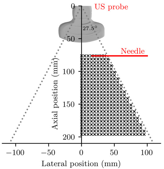 Intraoperative Needle Tip Tracking with an Integrated Fibre-Optic ...