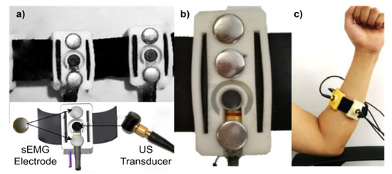 Multi-Sensing Techniques with Ultrasound for Musculoskeletal Assessment ...