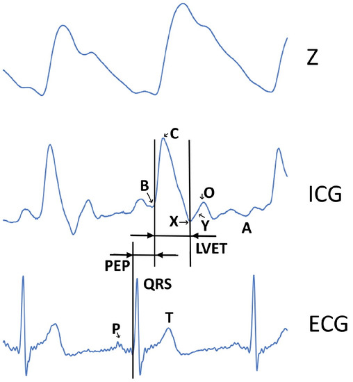 Non-Standard Electrode Placement Strategies for ECG Signal Acquisition