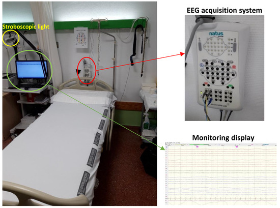 Wearable Epileptic Seizure Prediction System Based on Machine Learning ...
