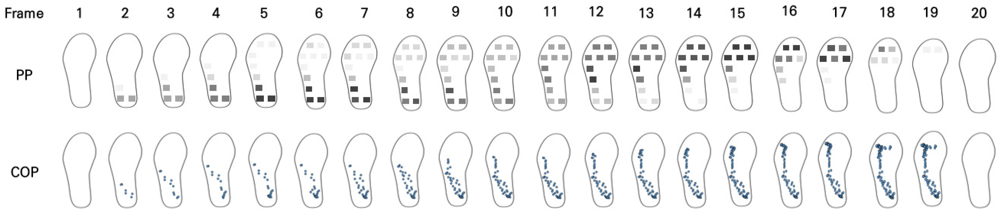 Customized Textile Capacitive Insole Sensor For Center Of Pressure Analysis