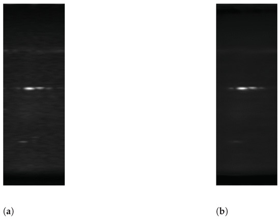 A Denoising Method Using Deep Image Prior to Human-Target Detection Using MIMO FMCW Radar