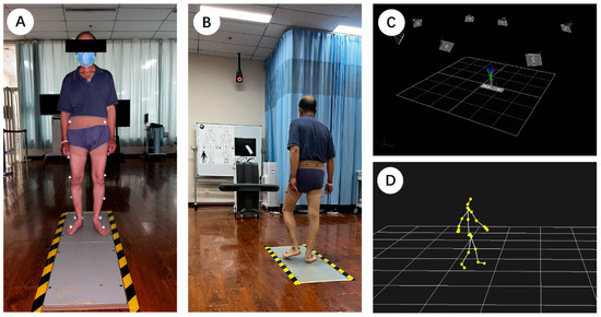 The Validity and Reliability of a New Intelligent Three-Dimensional Gait Analysis System in ...