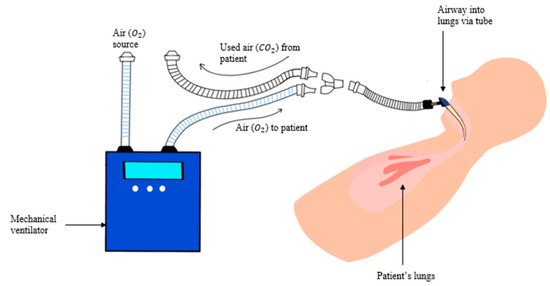 Inhalation Injury Grading Using Transfer Learning Based on Bronchoscopy ...