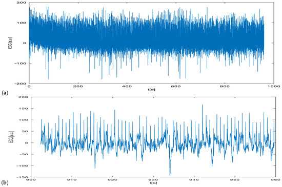 Non-Contact Monitoring of ECG in the Home Environment—Selecting Optimal ...