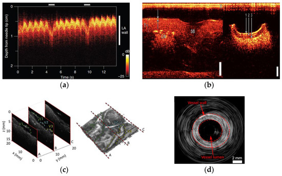 A Comprehensive Review on Photoacoustic-Based Devices for Biomedical ...