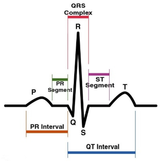 Sensors | Free Full-Text | A Denoising and Fourier Transformation-Based Spectrograms in ECG ...