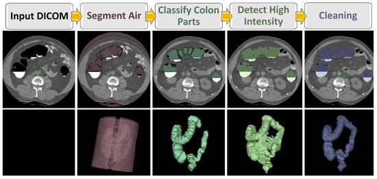 An AI-Based Colonic Polyp Classifier for Colorectal Cancer Screening ...
