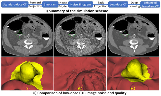 An AI-Based Colonic Polyp Classifier for Colorectal Cancer Screening ...