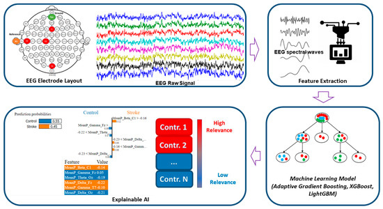 Sensors | Free Full-Text | Explainable Artificial Intelligence Model ... Sensors | Free Full-Text | Explainable Artificial Intelligence Model ...