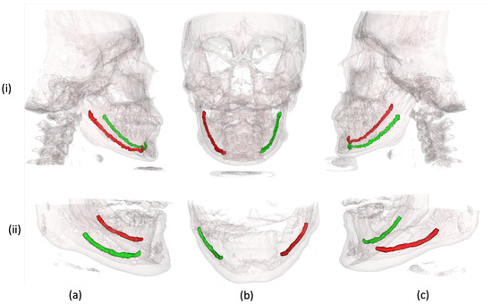 Dual-Stage Deeply Supervised Attention-Based Convolutional Neural Networks for Mandibular Canal ...