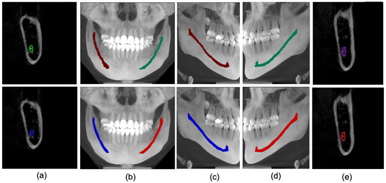 Dual-Stage Deeply Supervised Attention-Based Convolutional Neural Networks for Mandibular Canal ...
