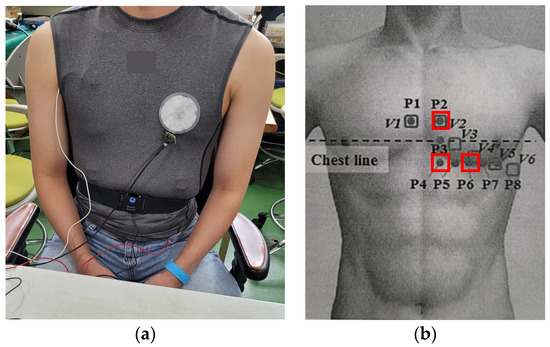 Wearable Fabric Loop Sensor Based on Magnetic-Field-Induced ...