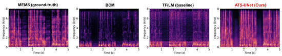 Enabling Real-Time On-Chip Audio Super Resolution for Bone-Conduction ...