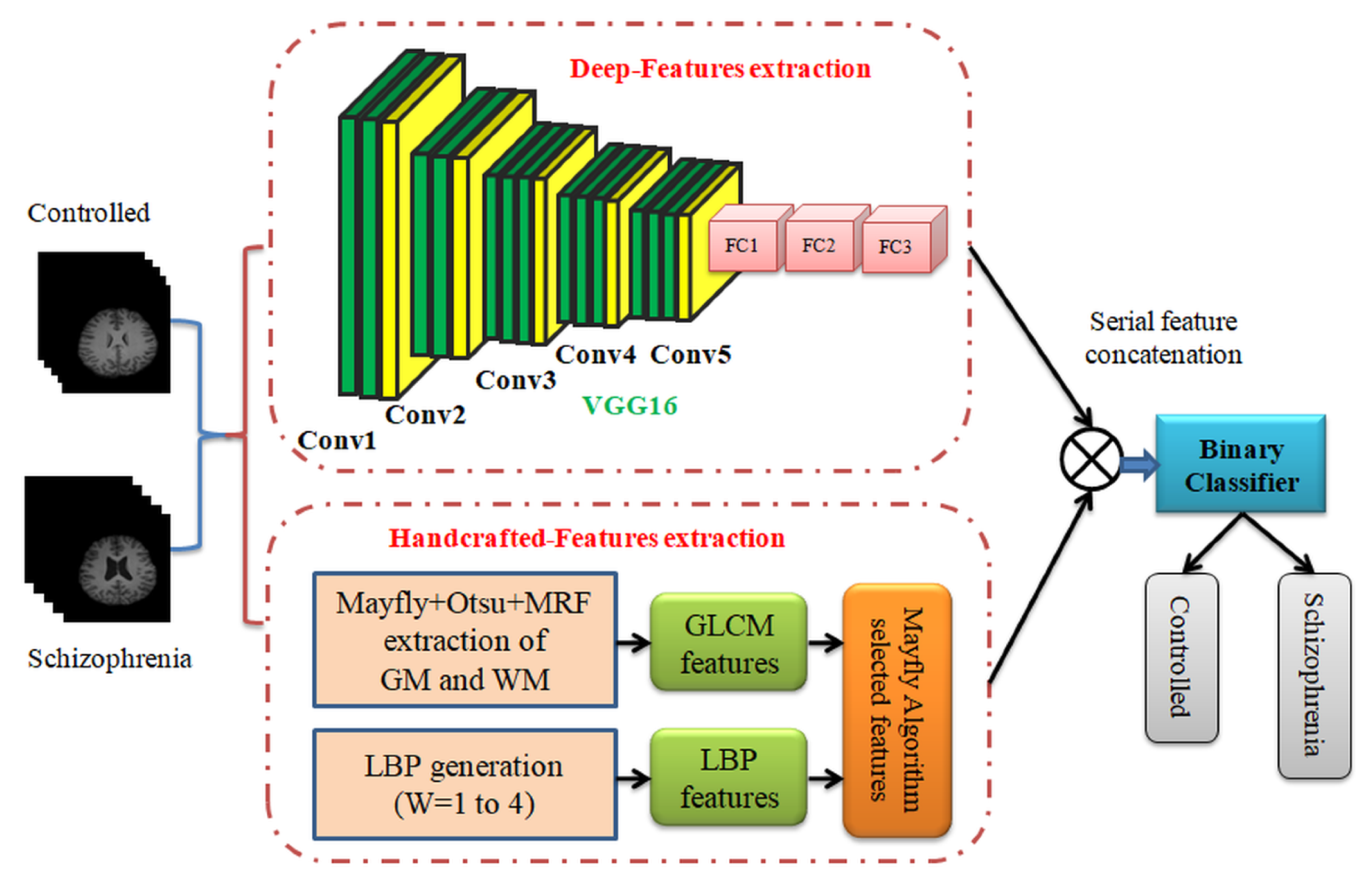 Framework to Detect Schizophrenia in Brain MRI Slices with Mayfly ...