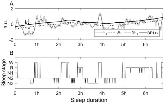 Sleep Quality Evaluation Based on Single-Lead Wearable Cardiac Cycle ...