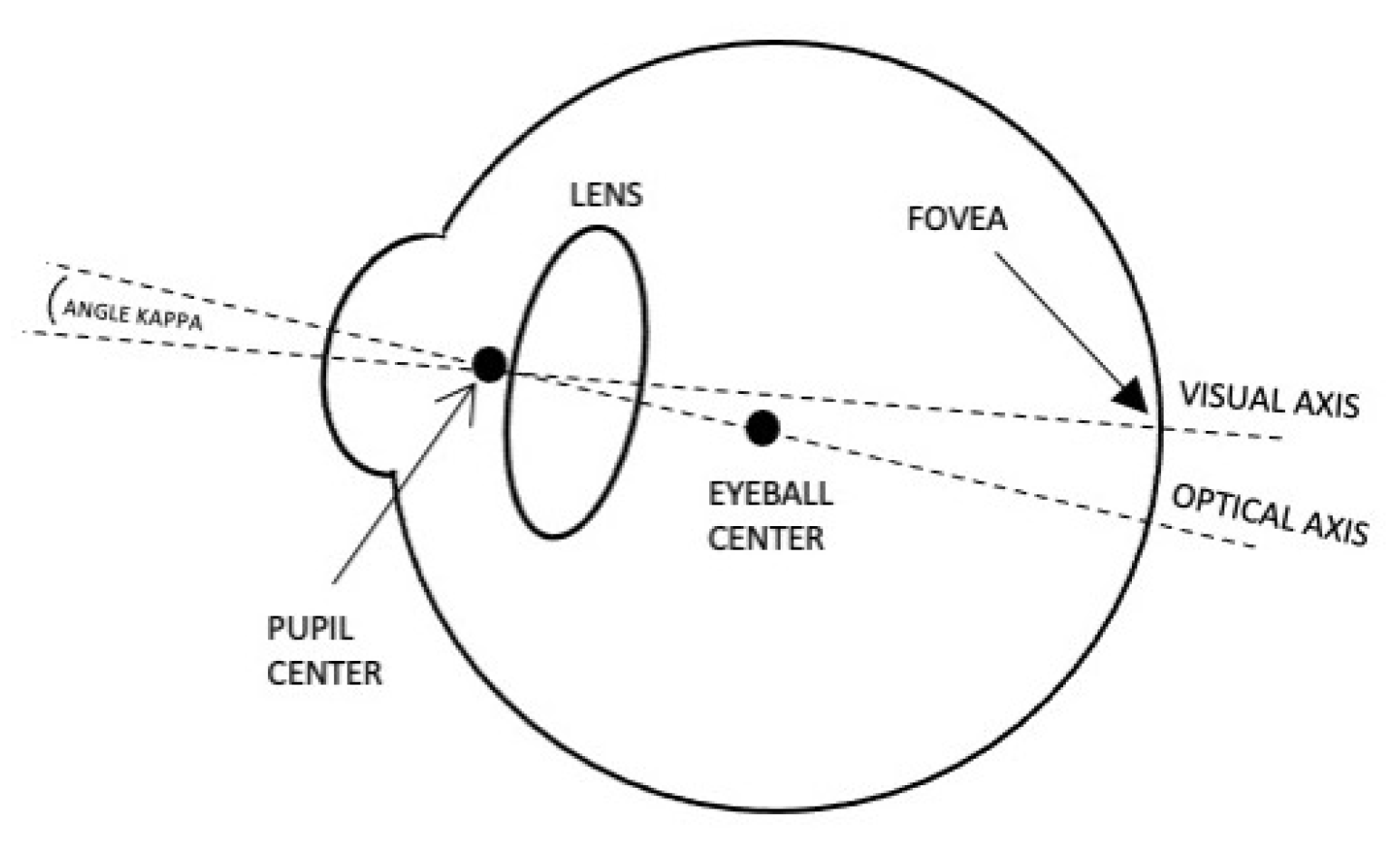 3D Gaze Estimation Using RGB-IR Cameras