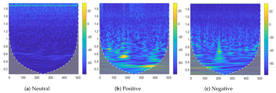An AI-Inspired Spatio-Temporal Neural Network for EEG-Based Emotional Status