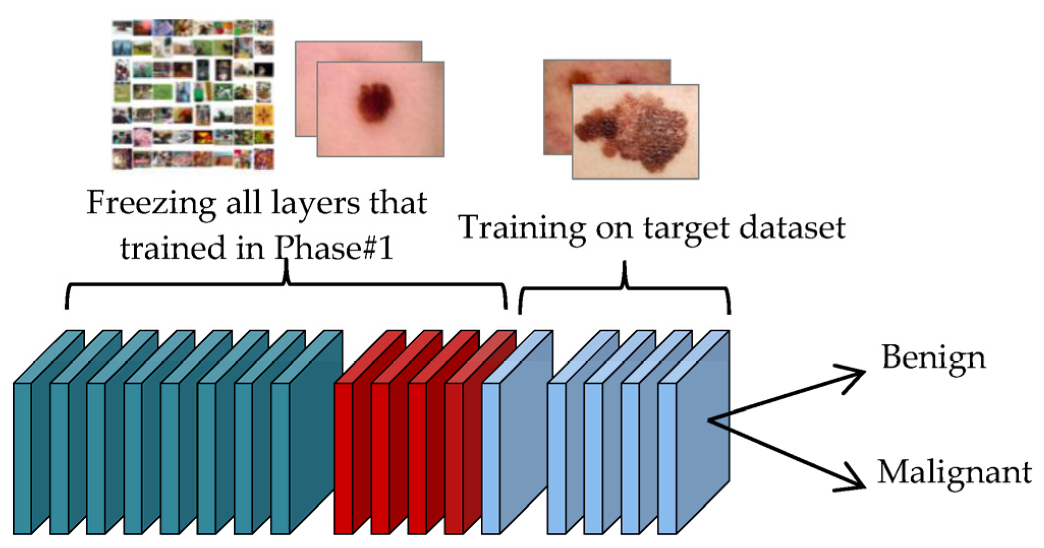 Sensors | Free Full-Text | Incorporating a Novel Dual Transfer Learning ...