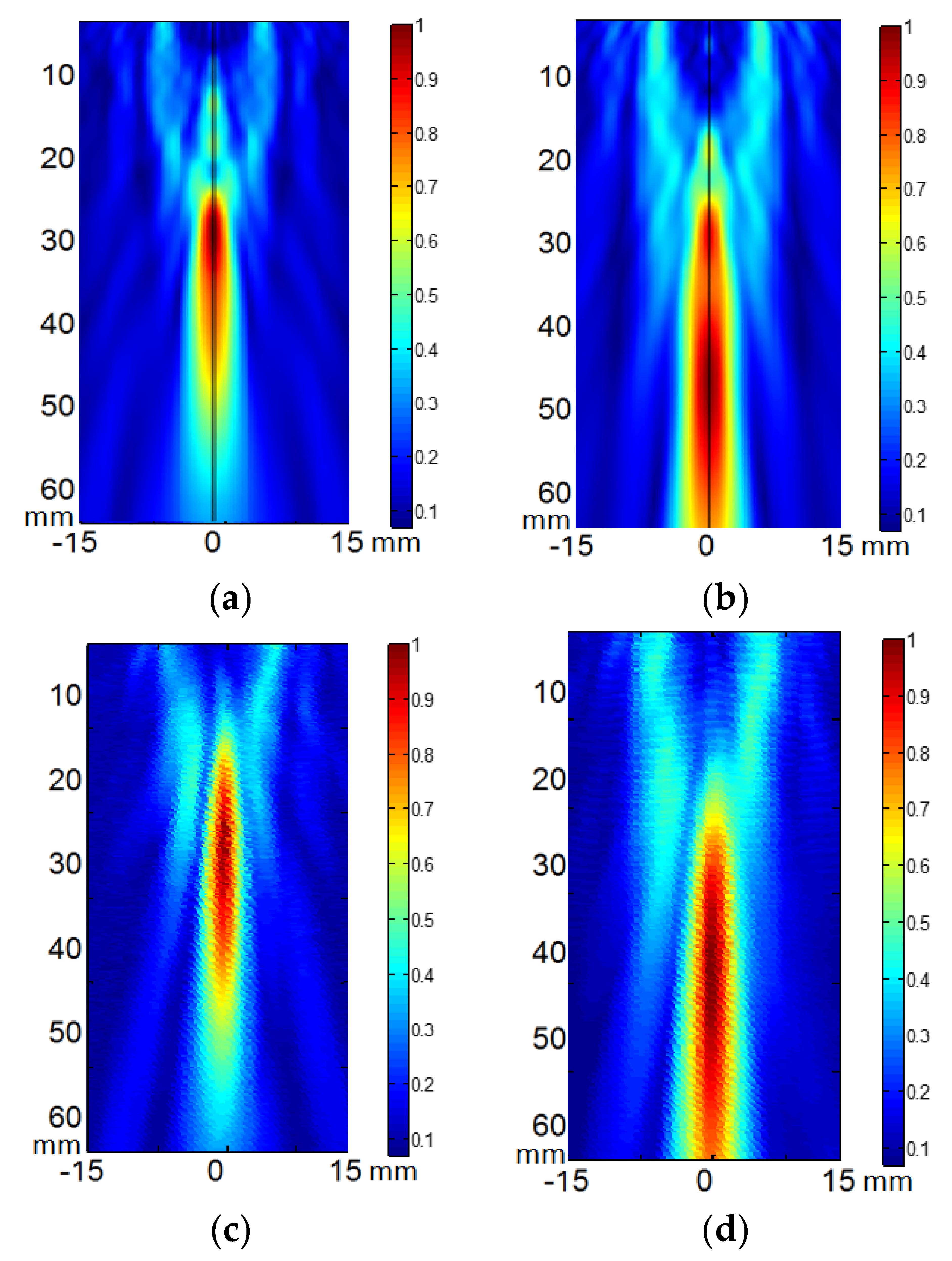 Device for Dual Ultrasound and Dry Needling Trigger Points Treatment