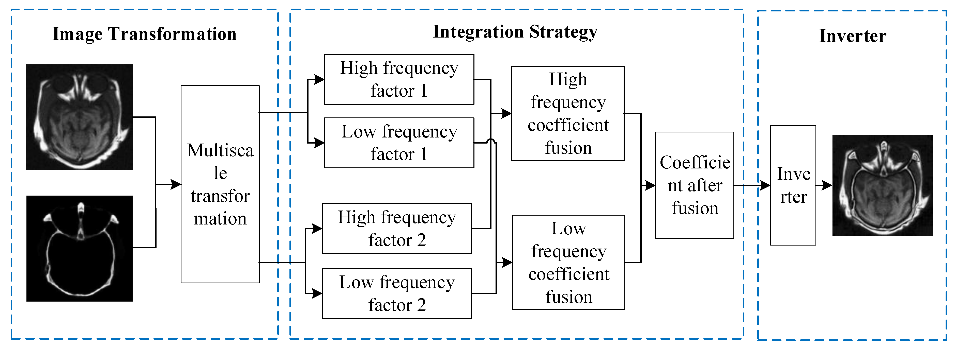 Sensors | Free Full-Text | Infrared and Visible Image Fusion Technology and Application: A Review