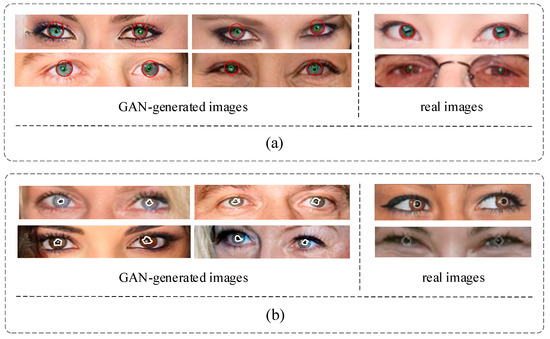 Global–Local Facial Fusion Based GAN Generated Fake Face Detection