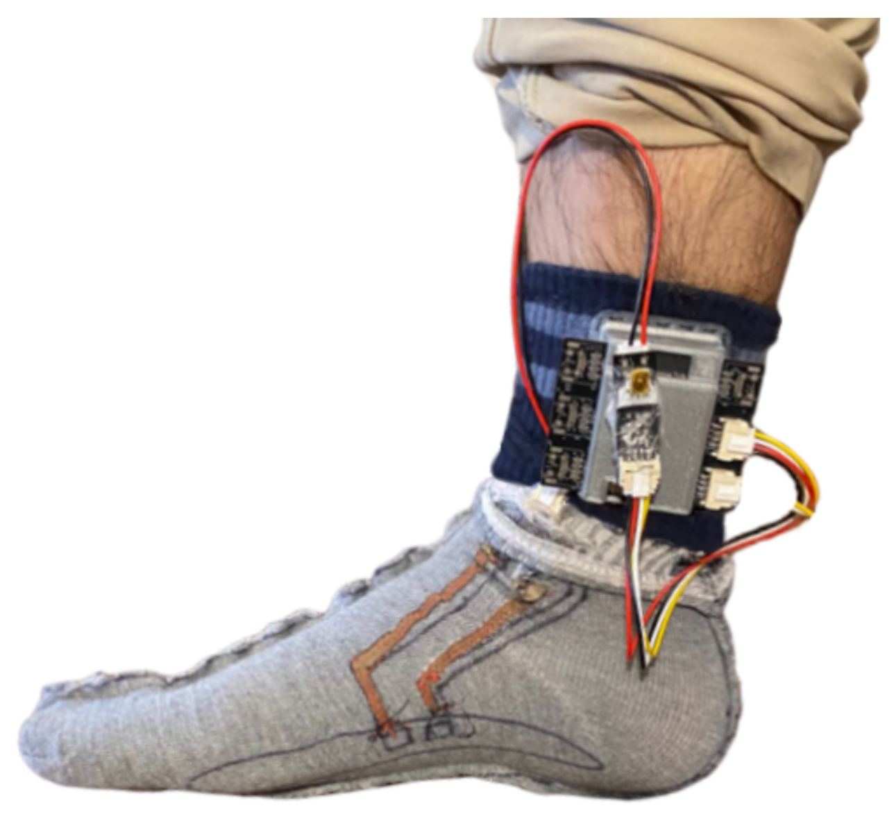 Feasibility of Electrodermal Activity and Photoplethysmography Data ...