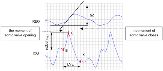 A New Method of Identifying Characteristic Points in the Impedance ...