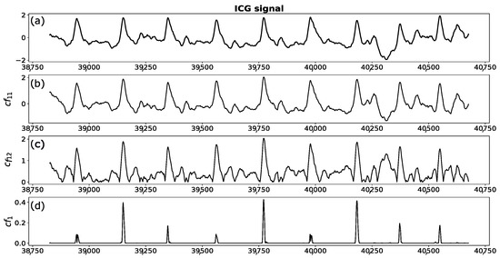 A New Method of Identifying Characteristic Points in the Impedance ...