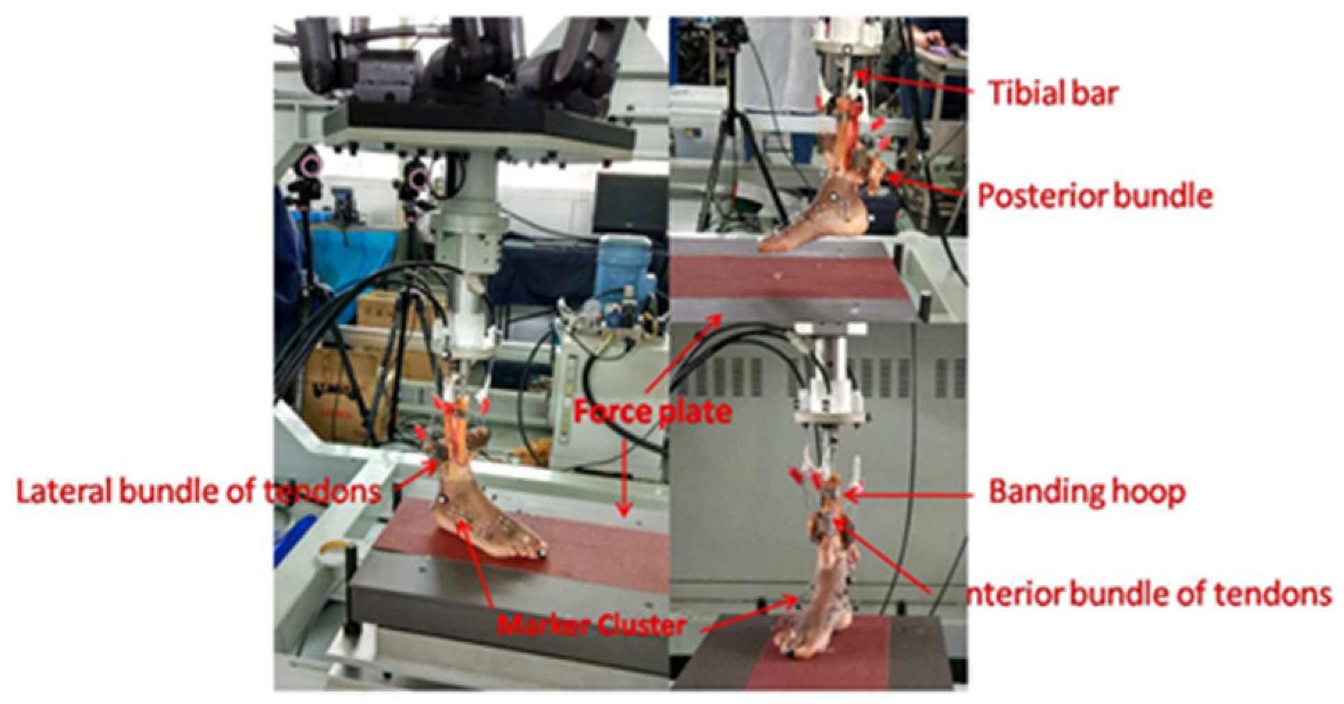 Robotic Technology in Foot and Ankle Surgery: A Comprehensive Review
