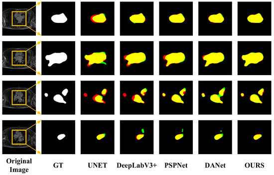 Sensors | Free Full-Text | Cardiac Magnetic Resonance Image ...