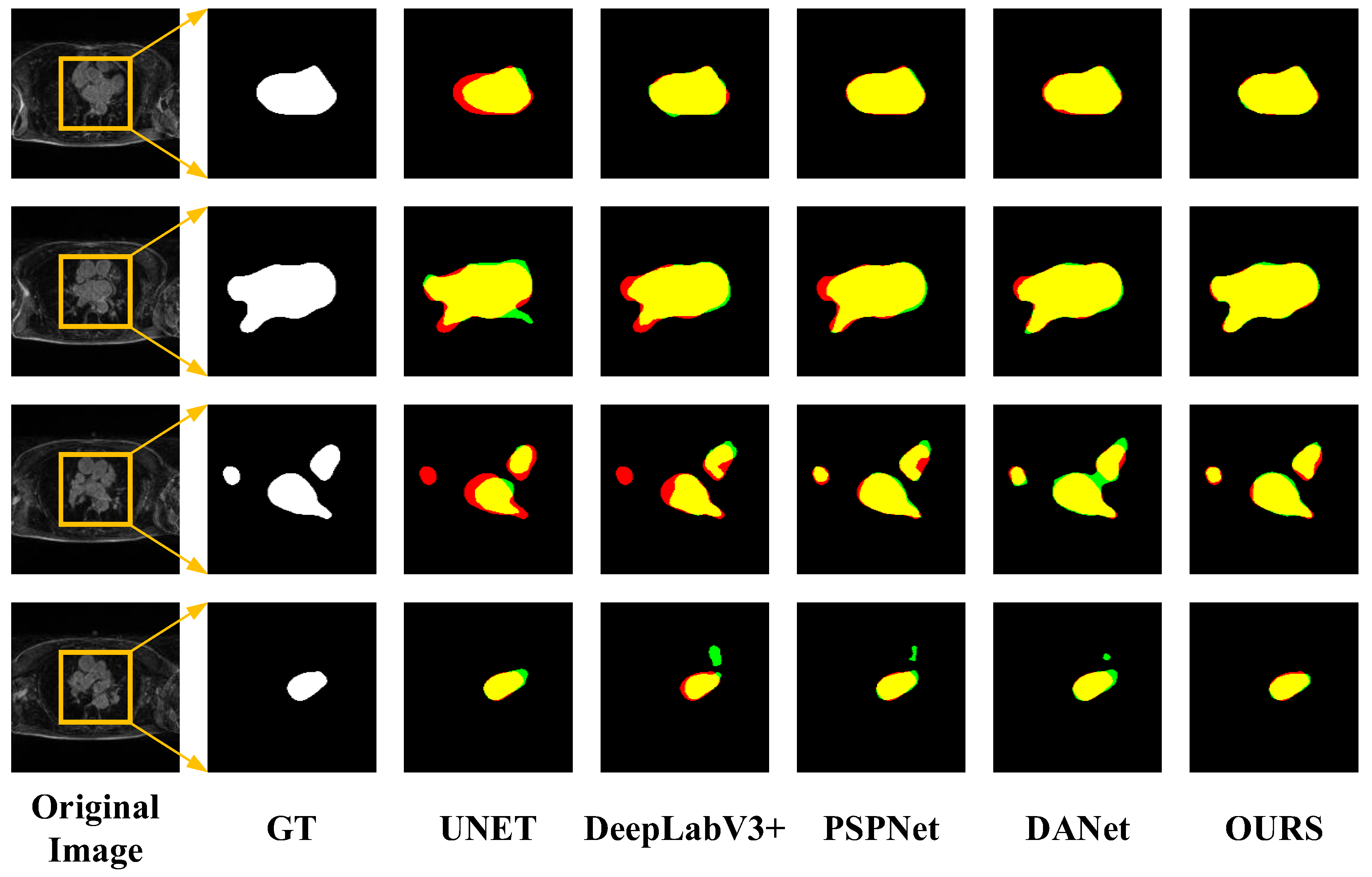 Sensors | Free Full-Text | Cardiac Magnetic Resonance Image Segmentation Method Based on Multi ...