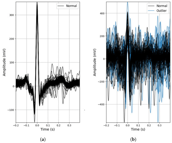 A Novel Smart Chair System for Posture Classification and Invisible ECG ...
