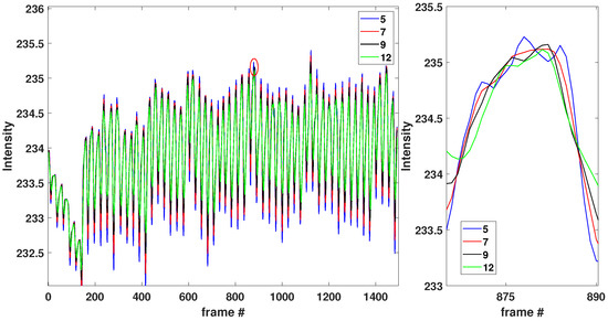 Calculation of Heartbeat Rate and SpO2 Parameters Using a Smartphone ...