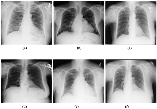 Sensors | Free Full-Text | DMFL_Net: A Federated Learning-Based Framework for the Classification ...