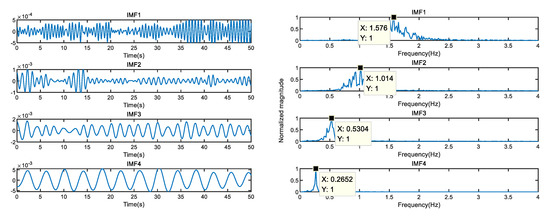 SSA-VMD for UWB Radar Sensor Vital Sign Extraction