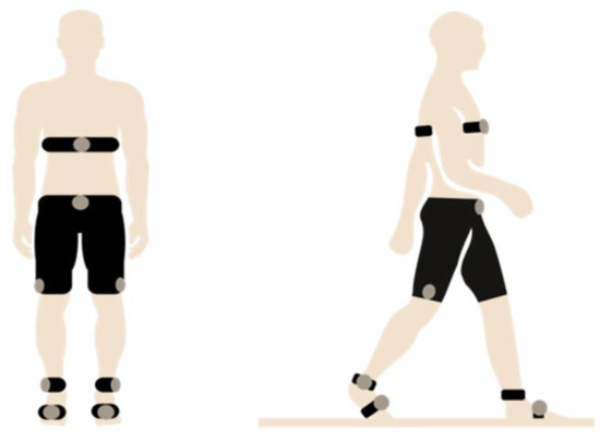 Multidimensional Biomechanics-Based Score to Assess Disease Progression ...